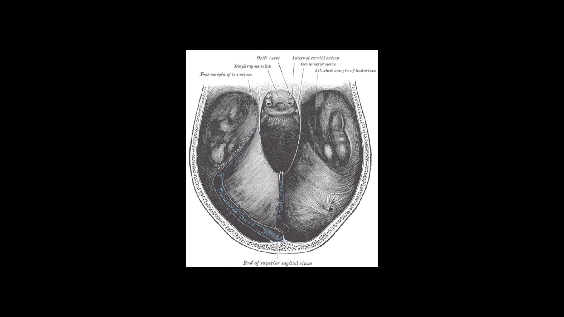 [CASE LÂM SÀNG] Kernohan's Phenomenon › Y khoa