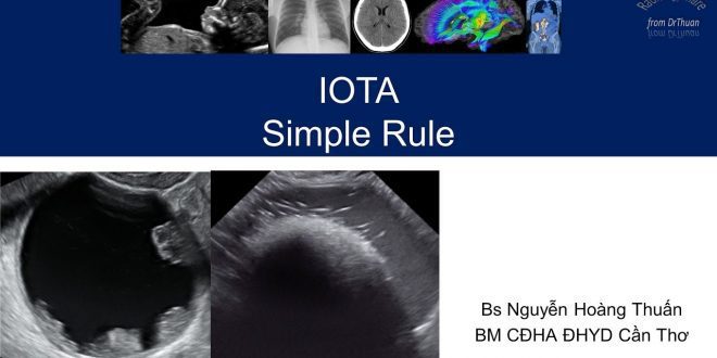 [Tài liệu] IOTA Simple Rule › Y khoa