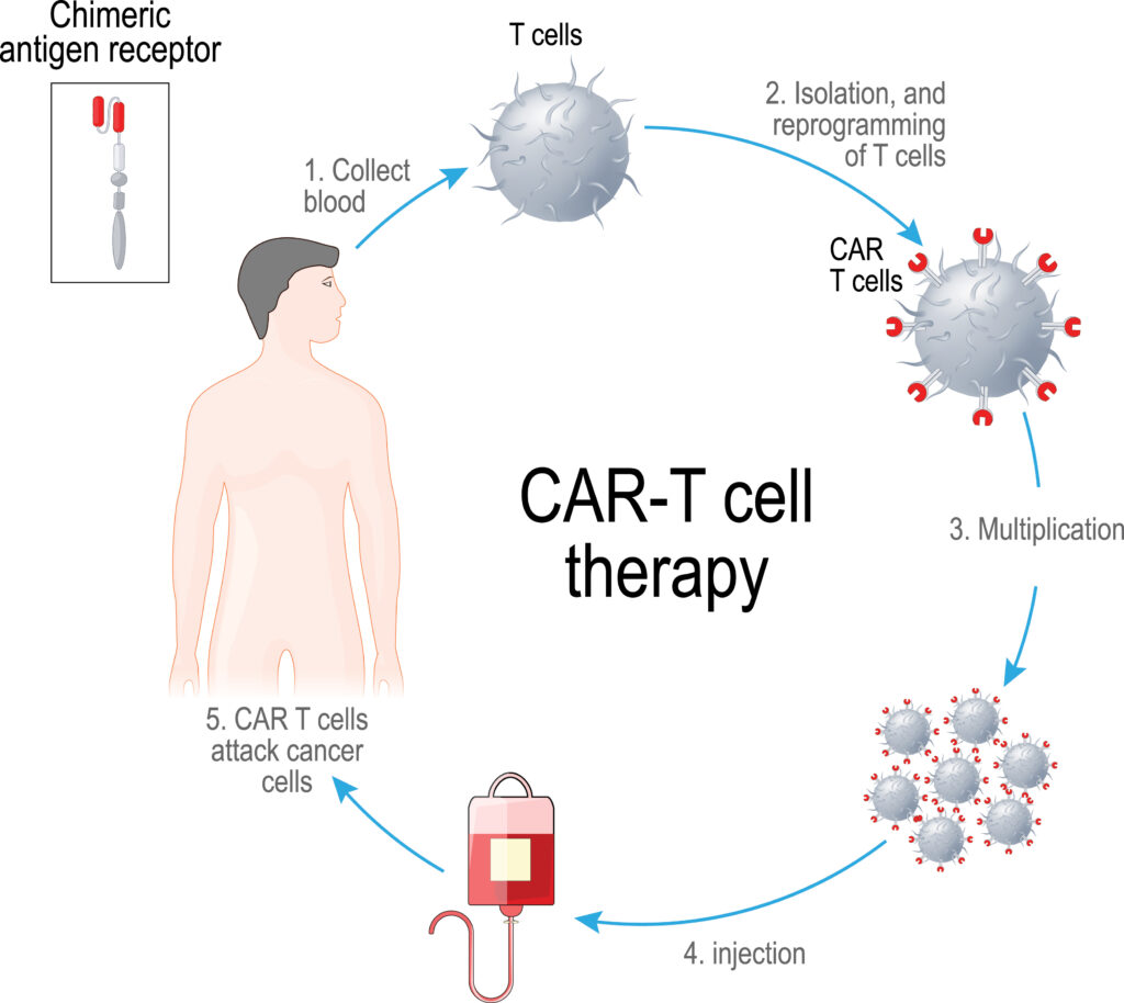 [ScienceDaily] Liệu pháp CAR T-cell có hiệu quả cao ở những bệnh nhân ...