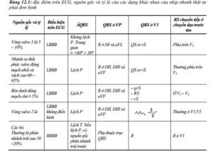 [ECG SỐ 12] Các dạng ECG của loạn nhịp thất › Y khoa