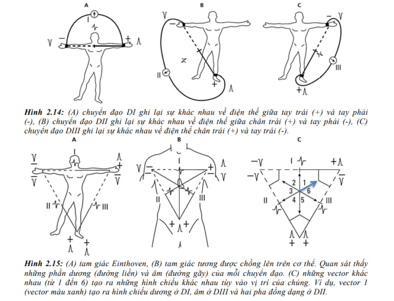 [ECG Số 2] Đường cong ECG: Định nghĩa và sự hình thành › Y khoa