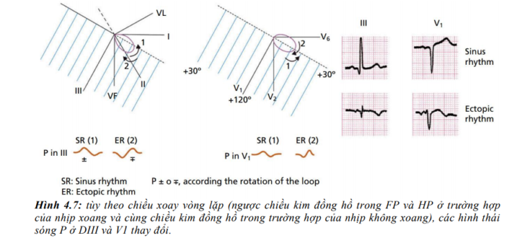 [ECG Số 4] Phân tích chi tiết về ECG › Y khoa