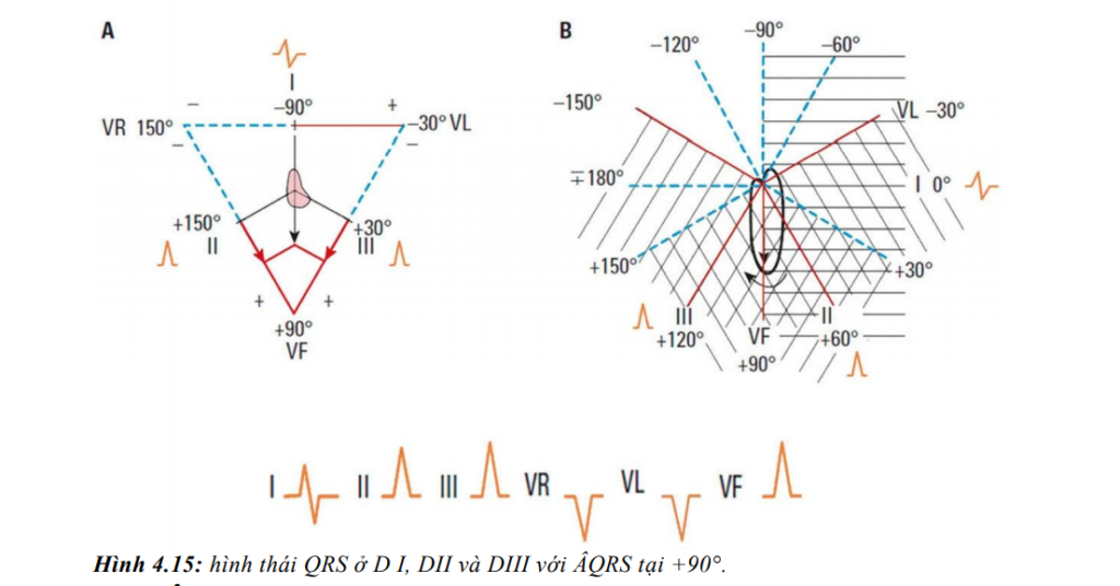 [ECG Số 4] Phân tích chi tiết về ECG › Y khoa