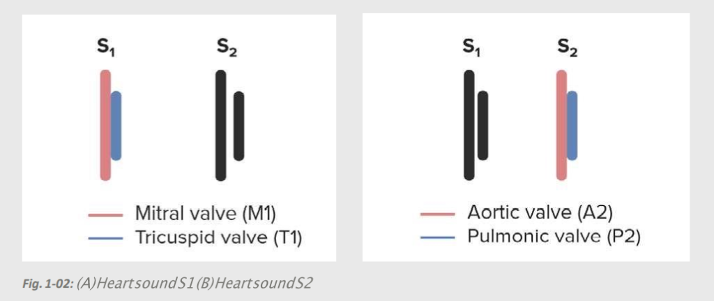 [Bệnh học tim mạch 1] Những kiến thức quan trọng nhất về tiếng tim › Y khoa