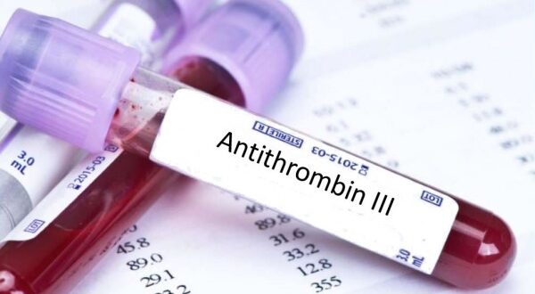 [Xét nghiệm 11] Antithrombine III (AT III) (Antithrombine III ...