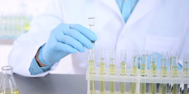[Xét nghiệm 50] Glucose niệu (Glycosurie/ Glucose, Urine) › Y khoa