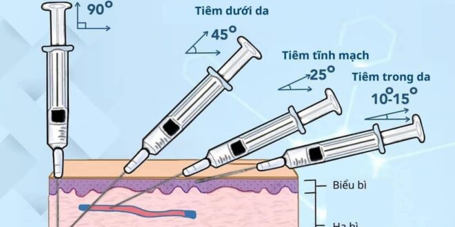 CÁC LOẠI TIÊM › Y khoa