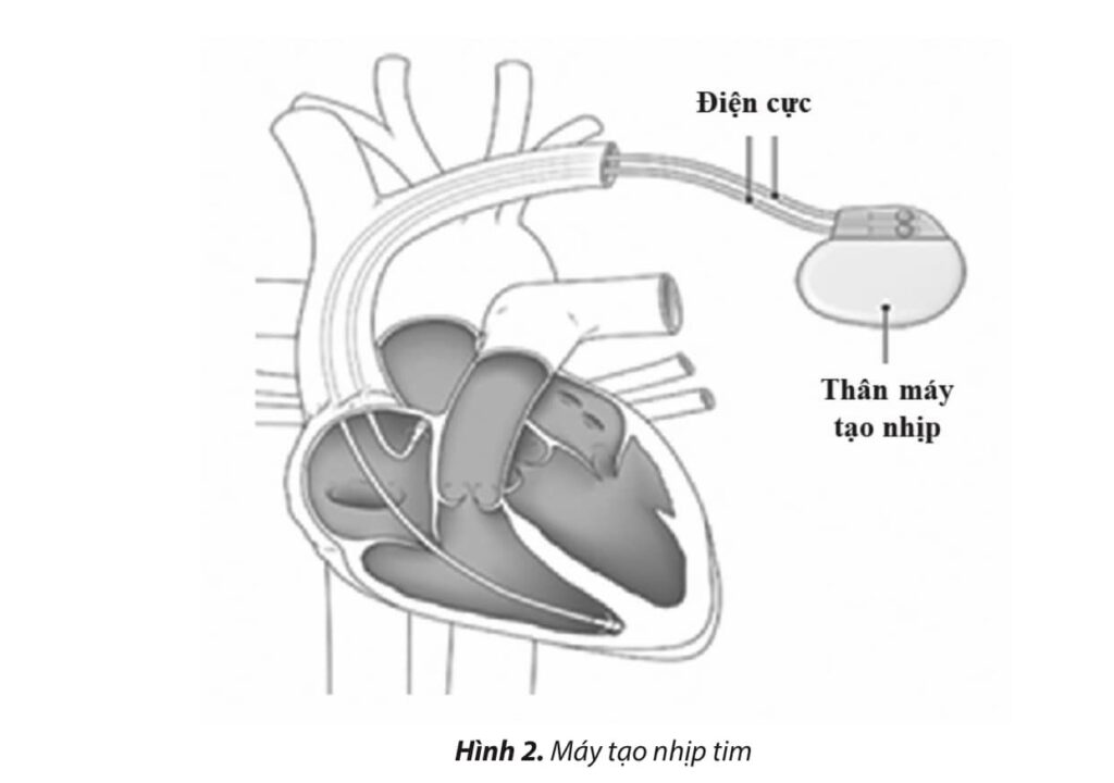 MÁY TẠO NHỊP TIM › Y khoa