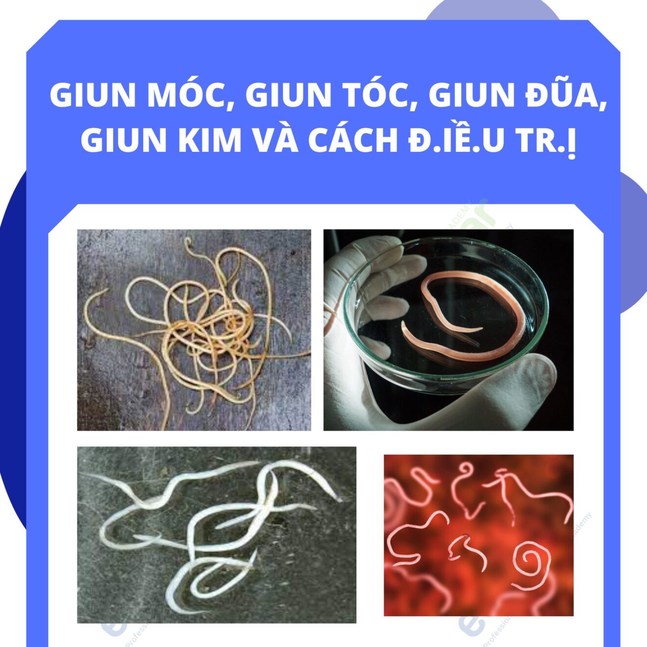 [Cập nhật] GIUN MÓC, GIUN TÓC, GIUN ĐŨA, GIUN KIM VÀ CÁCH Đ.IỀ.U TR.Ị ...