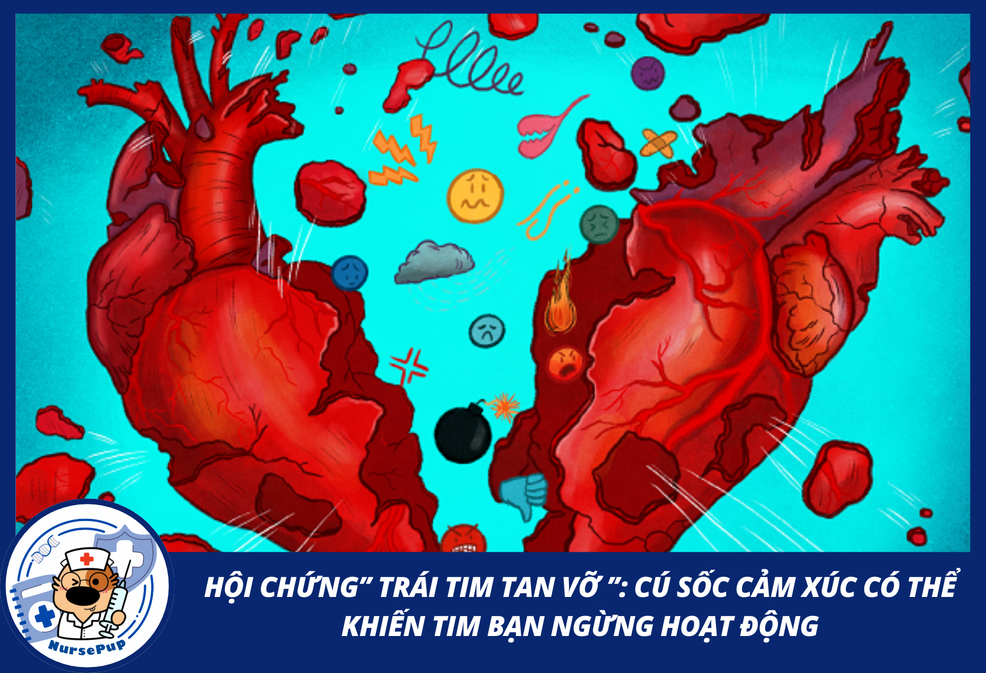 Hội chứng “Trái tim tan vỡ’’ (Takotsubo Syndrome): Cú sốc cảm xúc thực ...